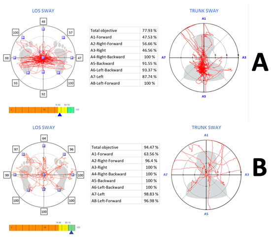 Age-Related Decline in Cervical Proprioception and Its Correlation with ...