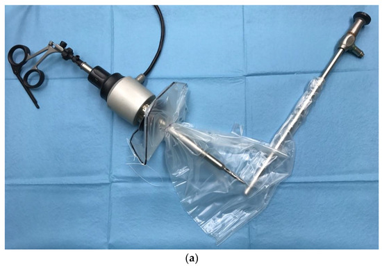 Contained Power Morcellation in Laparoscopic Uterine Myoma Surgeries: A ...
