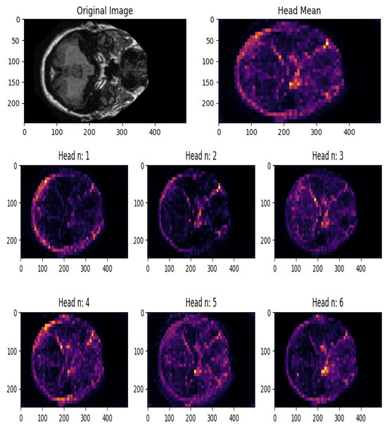 Healthcare | Free Full-Text | Artificial Cognition for Detection of ...