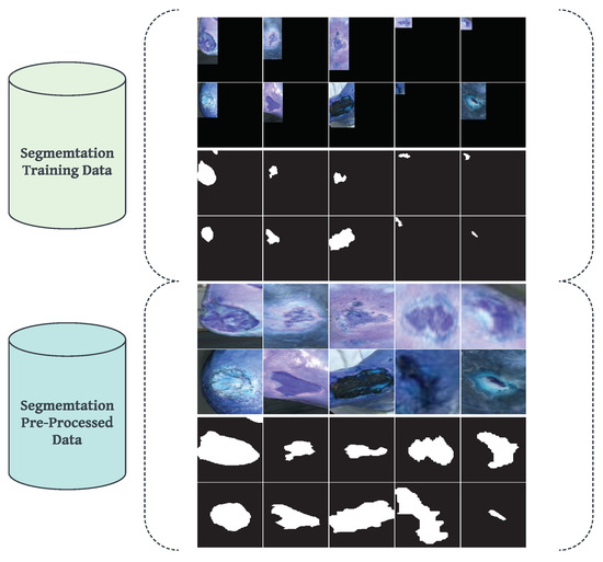 CADFU for Dermatologists: A Novel Chronic Wounds & Ulcers Diagnosis System with DHuNeT (Dual ...