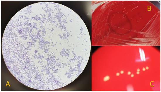 Case Report and Literature Review of Parvimonas micra: Difficult-to ...