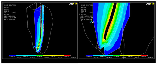 Healthcare | Free Full-Text | Endodontic Dentistry: Analysis of ...