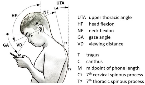 User Walking Speed and Standing Posture Influence Head/Neck Flexion and ...