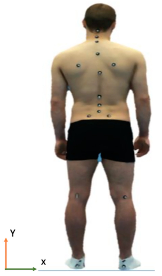 Measurement of Three-Dimensional Back Shape of Normal Adults Using a ...