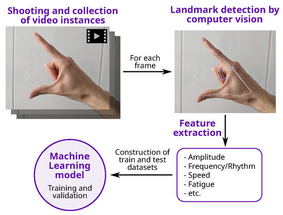 Healthcare | Free Full-Text | Computer Vision for Parkinson’s Disease ...