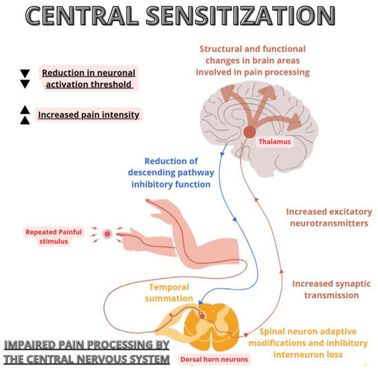 Whole Body Cryostimulation: A New Adjuvant Treatment in Central ...