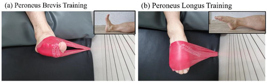 Effects of Peroneus Brevis versus Peroneus Longus Muscle Training on ...