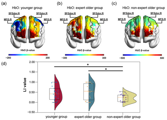 Hemispheric Lateralization in Older Adults Who Habitually Play Darts: A ...