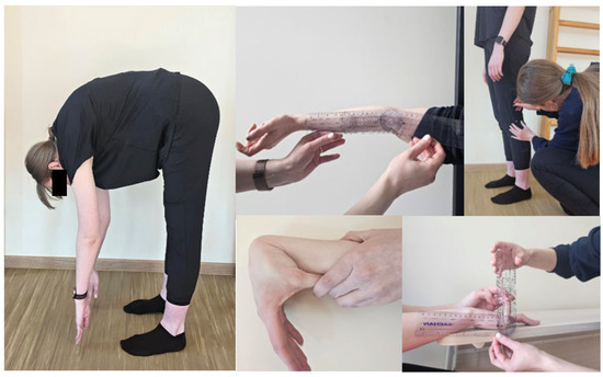 Present but Ignored: Physical Condition and Health-Related Quality of ...