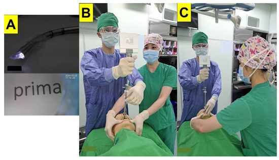 Structured Routine Use of Styletubation for Oro-Tracheal Intubation in ...