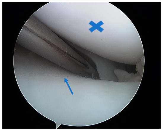 Cartilage Integrity: A Review of Mechanical and Frictional Properties ...