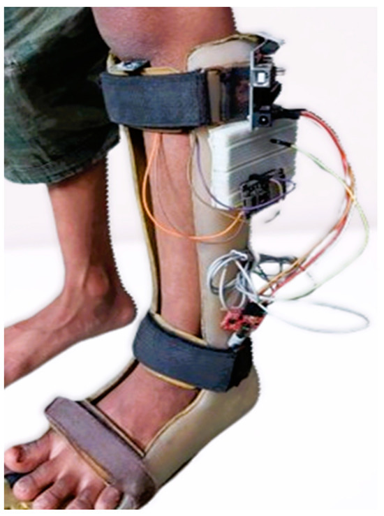 Deep Learning and IoT-Based Ankle–Foot Orthosis for Enhanced Gait Optimization