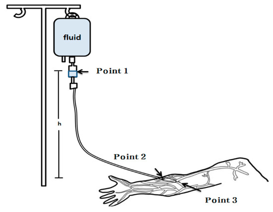 Comparison of Fluid Flow Rates by Fluid Height and Catheter Size in ...