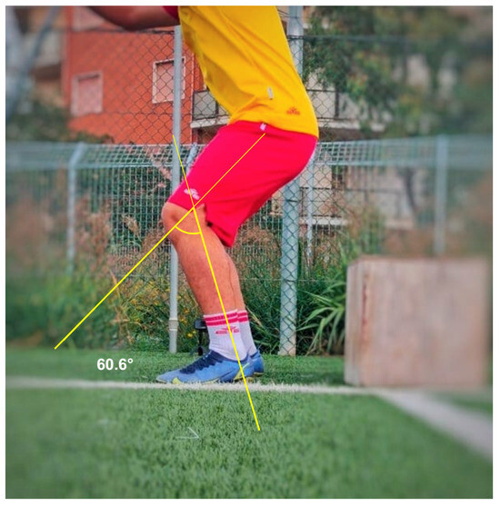 The Protective Role of the FIFA 11+ Training Program on the Valgus ...