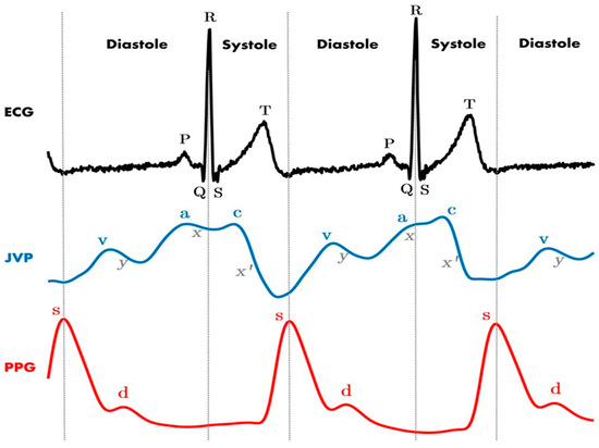 Central Venous Access: An Update on Modern Techniques to Avoid ...