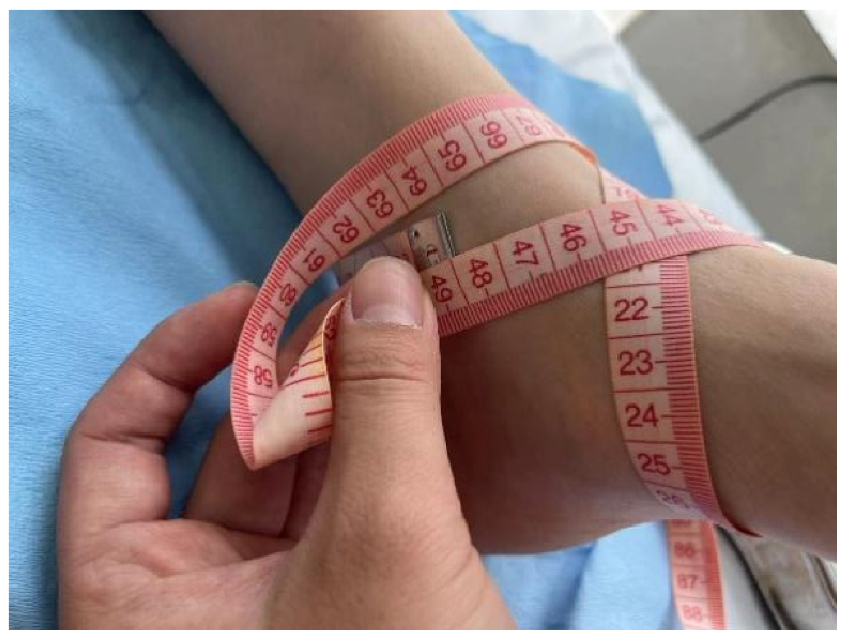 Clinical Outcomes of Non-Elastic Compression Bandage Versus Elastic ...