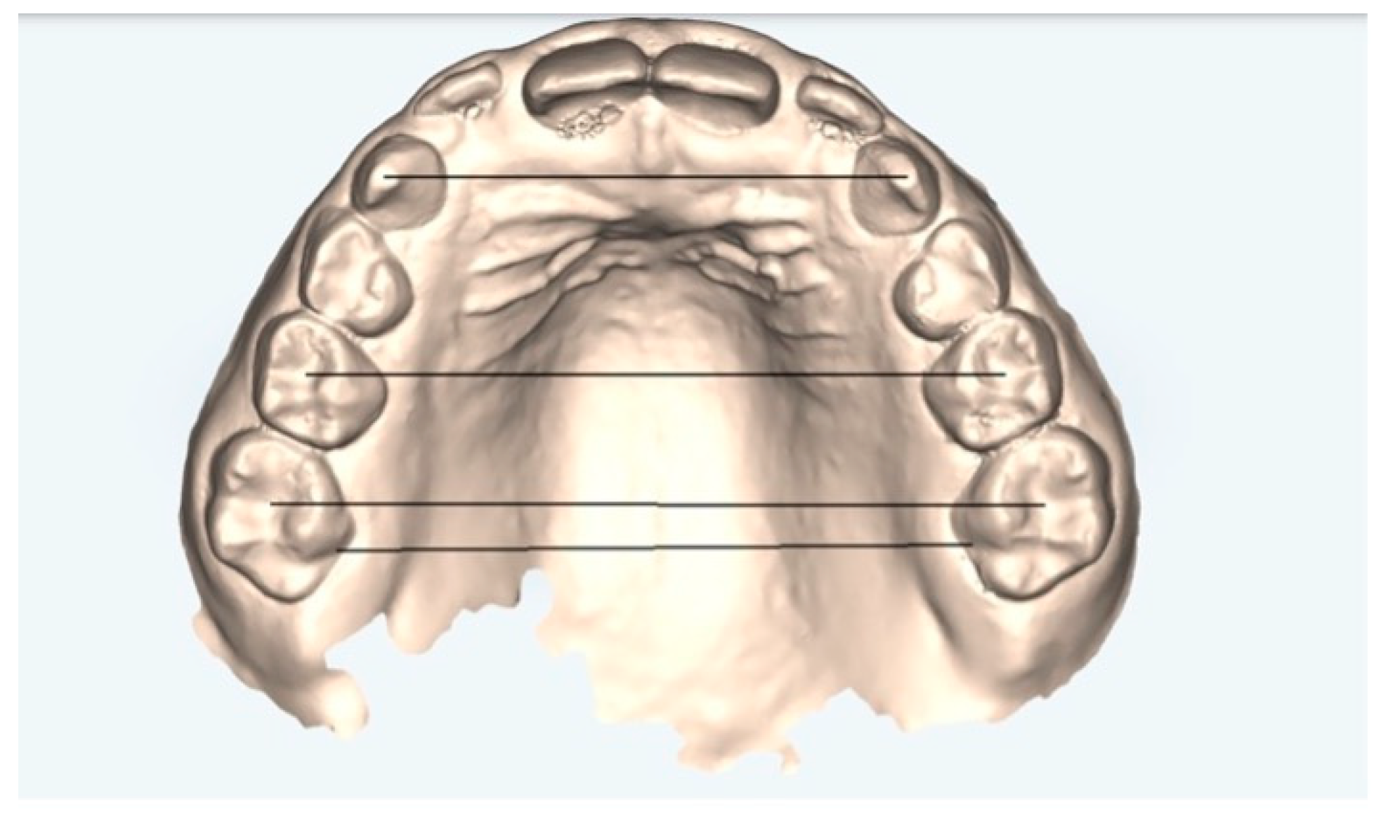 Efficacy and Predictability of Maxillary and Mandibular Dental Arch ...
