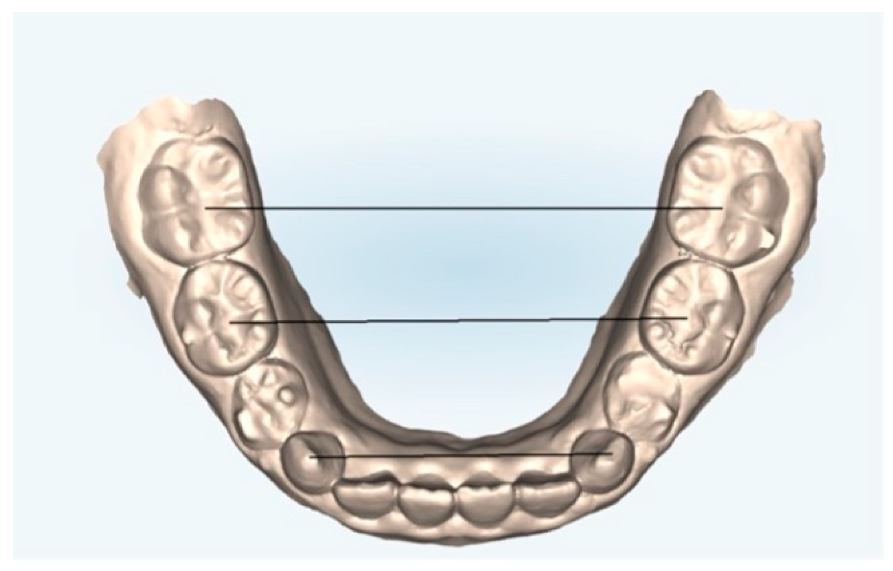 Efficacy and Predictability of Maxillary and Mandibular Dental Arch ...
