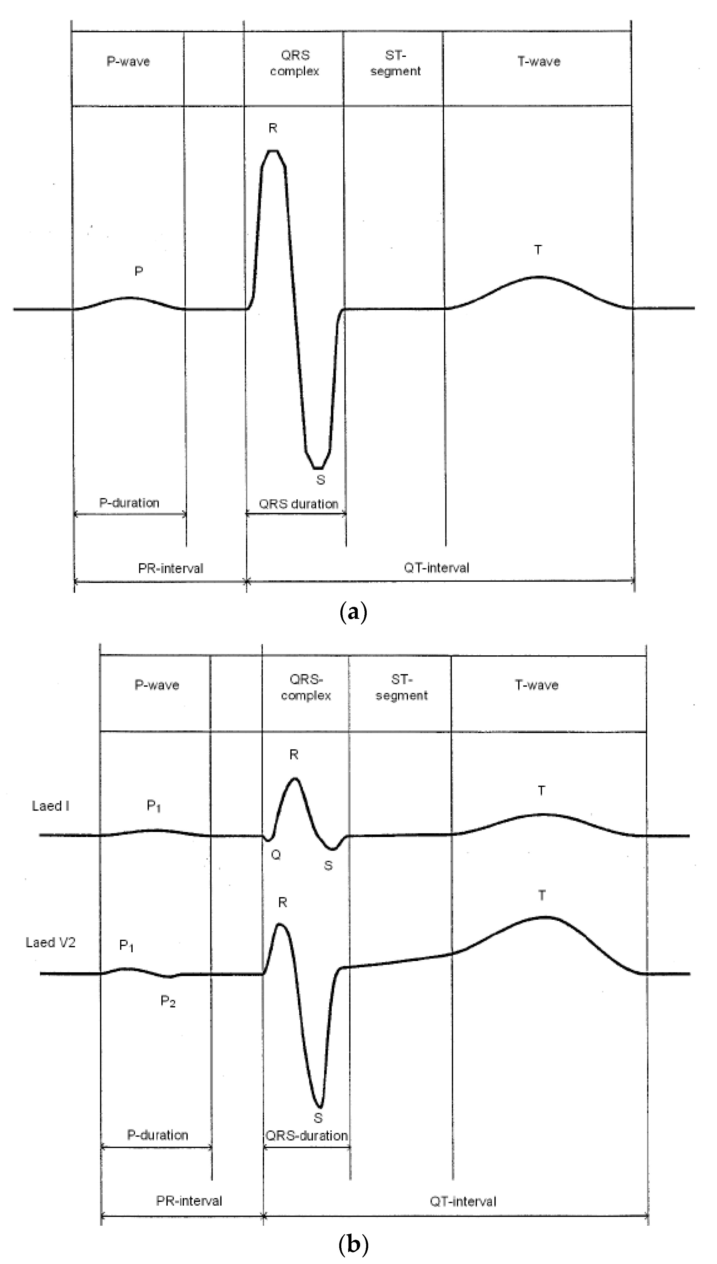 The New ISO/IEC Standard for Automated ECG Interpretation