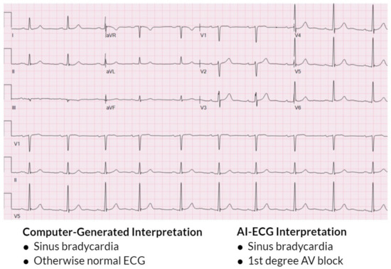 ECG Interpretation: Clinical Relevance, Challenges, and Advances