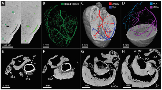 X-ray-Based 3D Histology of Murine Hearts Using Contrast-Enhanced ...