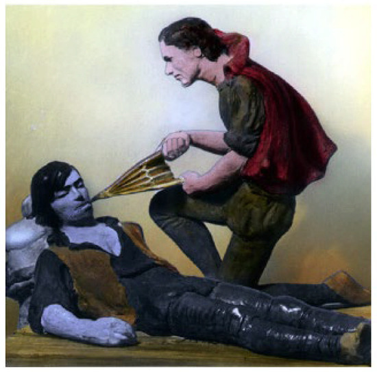 The History of Cardiopulmonary Resuscitation and Where We Are Today