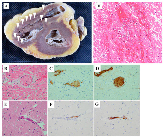 Hematology Reports | An Open Access Journal from MDPI