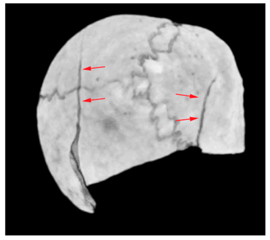 The Return of the Warrior: Combining Anthropology, Imaging Advances ...