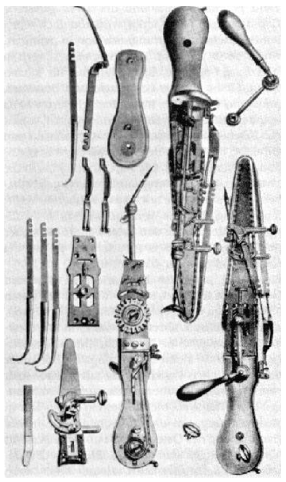Virtually Reconstructing Bernhard Heine’s Osteotome