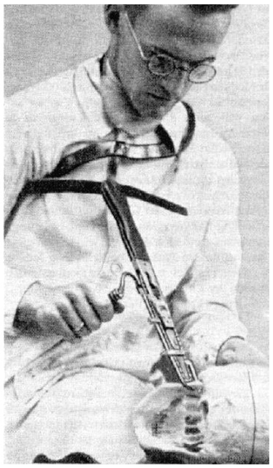 Virtually Reconstructing Bernhard Heine’s Osteotome