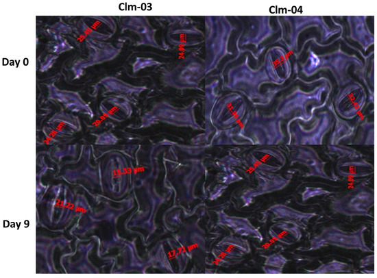 Morphological, Physiological, and Molecular Stomatal Responses in Local ...