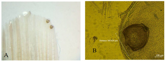Glochidia Infection of Endemic Fishes from Lake Prespa, N. Macedonia