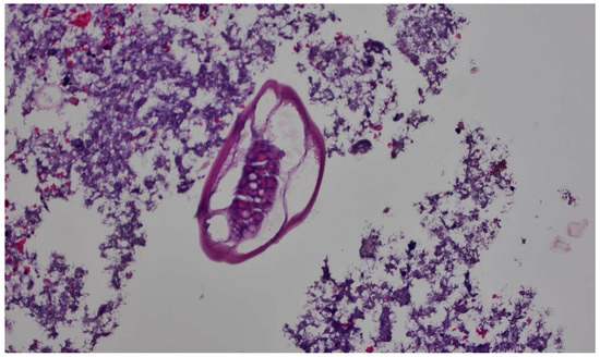 Enterobius Vermicularis Slide