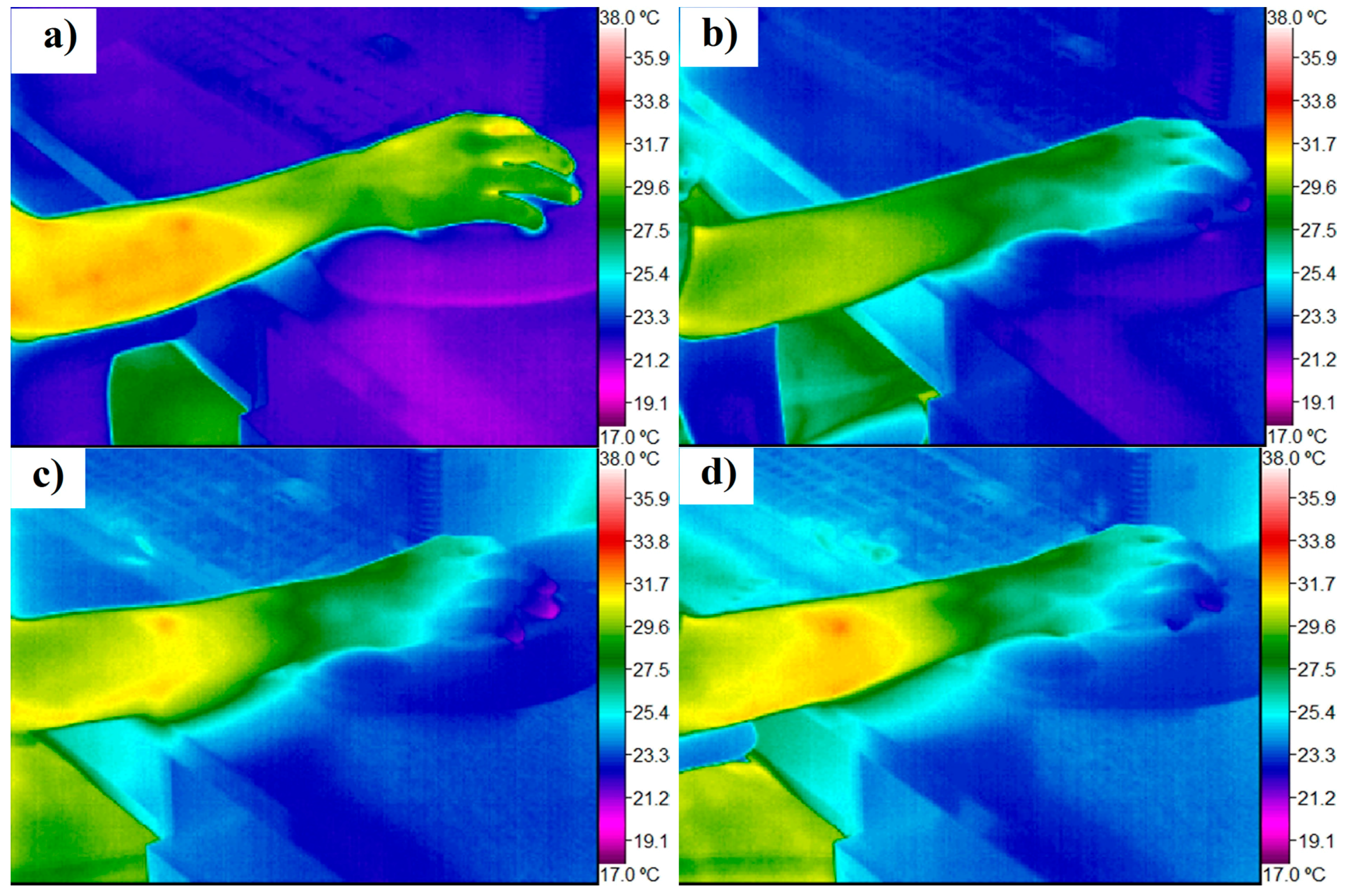Wrist Hypothermia Related to Continuous Work with a Computer Mouse: A ...