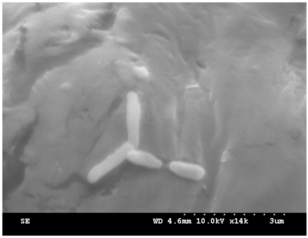 Biodegradation of di-n-Butyl Phthalate by Achromobacter sp. Isolated ...