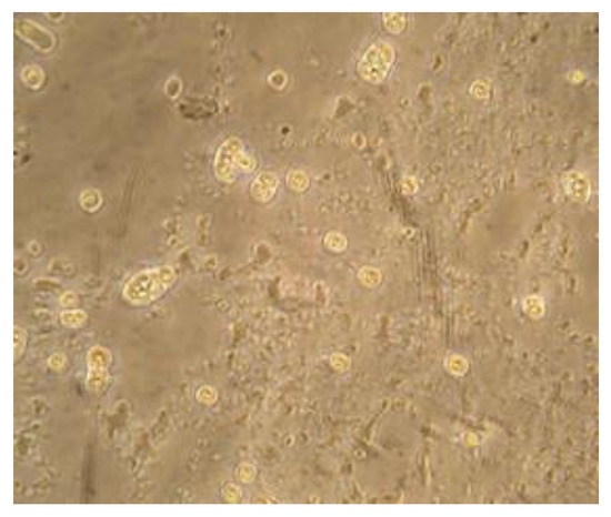 IJERPH | Free Full-Text | Evaluation of Microbiological and Free-Living ...