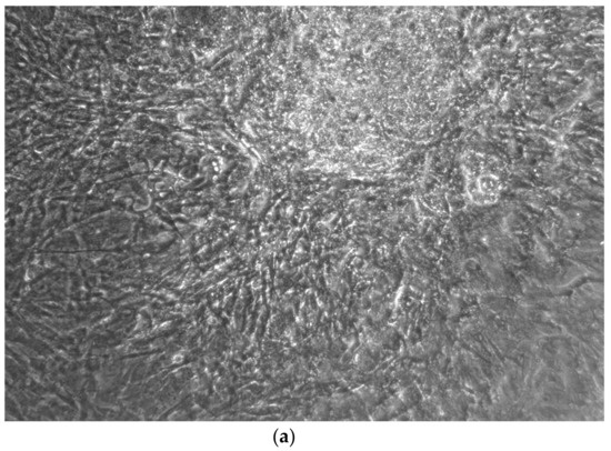 New Application of Osteogenic Differentiation from HiPS Stem Cells for ...