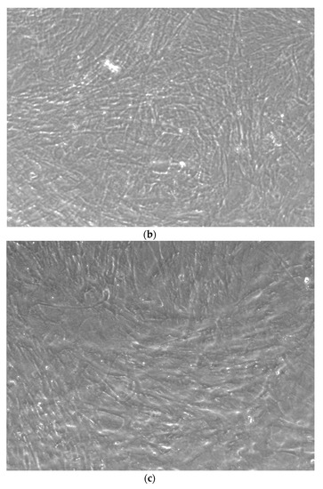 New Application of Osteogenic Differentiation from HiPS Stem Cells for ...