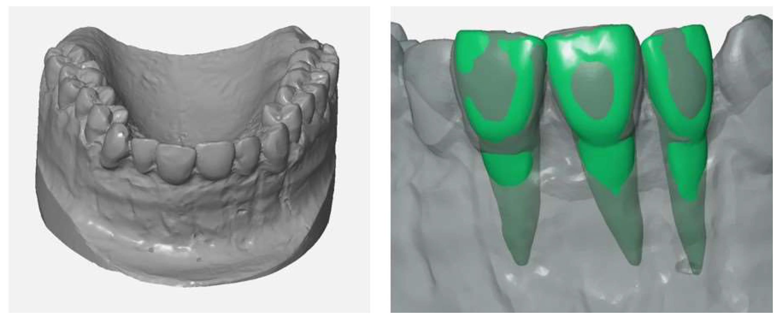 3D-printed Surgical Training Model Based on Real Patient Situations for ...