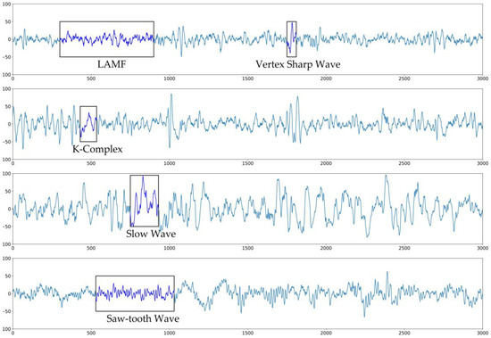 Convolution- and Attention-Based Neural Network for Automated Sleep Stage Classification