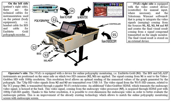A New Technological Advancement of the Drug-Induced Sleep Endoscopy ...