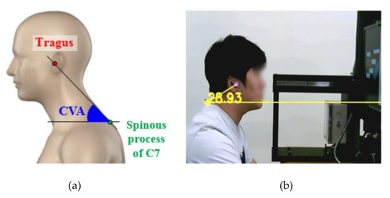 A Comparison Study of Posture and Fatigue of Neck According to Monitor ...