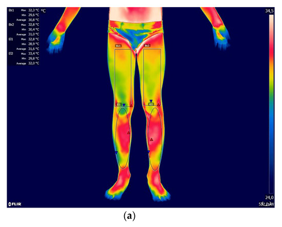 IJERPH | Special Issue : Thermal Imaging in Body and Skin Temperature ...