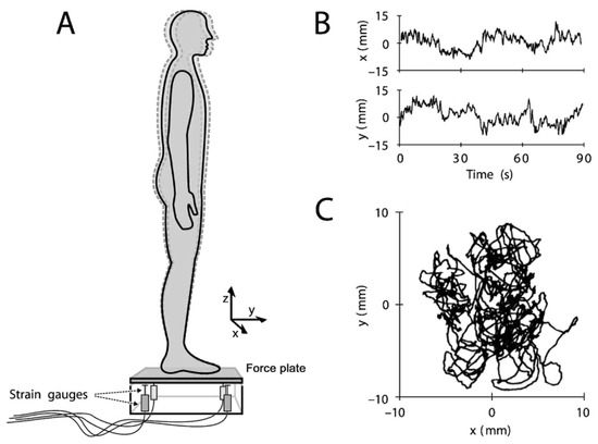 Review of the Upright Balance Assessment Based on the Force Plate