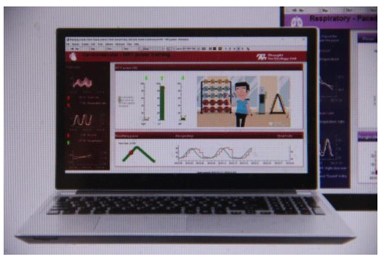 Neurophysiological Approach by Self-Control of Your Stress-Related ...