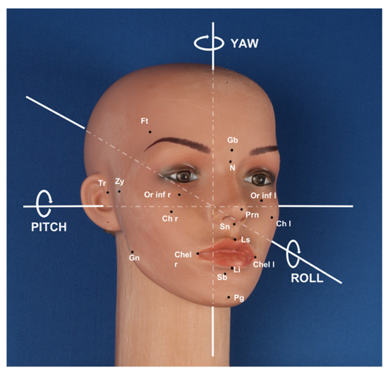 Does Head Orientation Influence 3D Facial Imaging? A Study on Accuracy ...