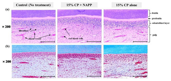 The Whitening Effect and Histological Safety of Nonthermal Atmospheric ...