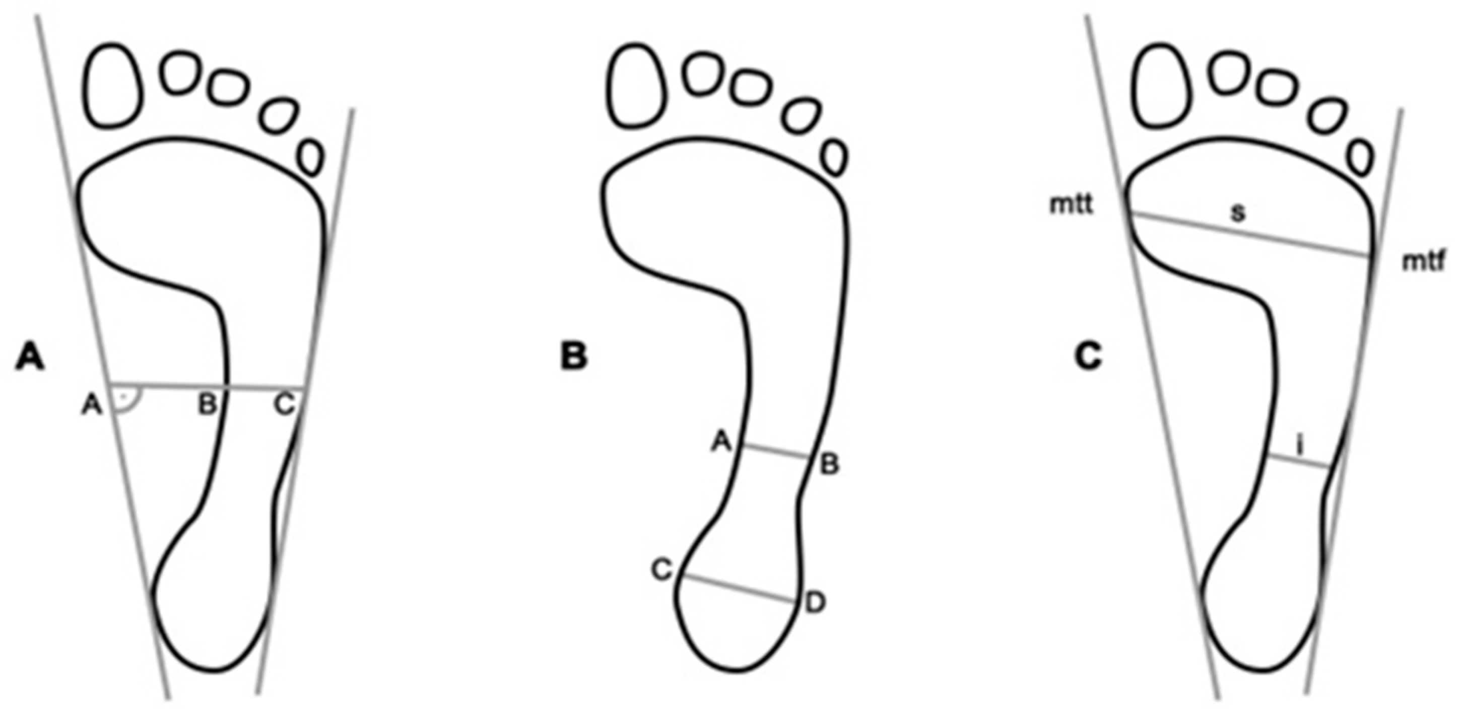 Assessment of the Foot’s Longitudinal Arch by Different Indicators and ...