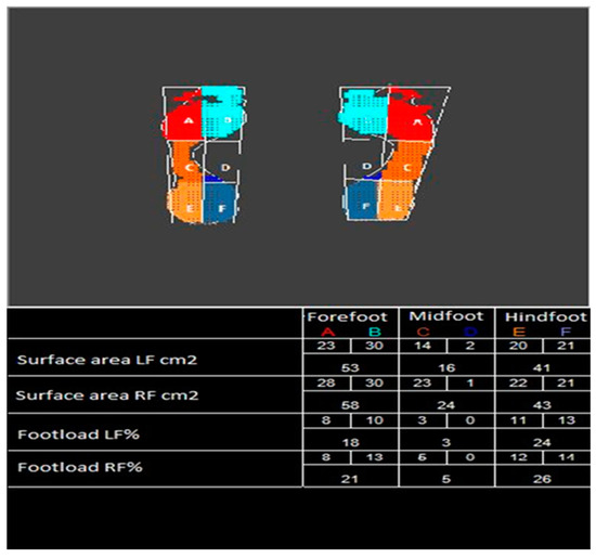 Assessment of the Foot’s Longitudinal Arch by Different Indicators and ...