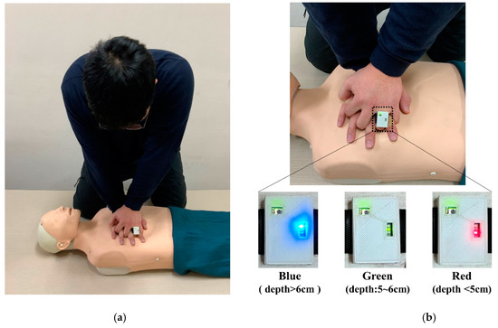 Impact of a Smart-Ring-Based Feedback System on the Quality of Chest ...